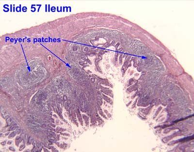 Histology Of Ileum Peyers Patches
